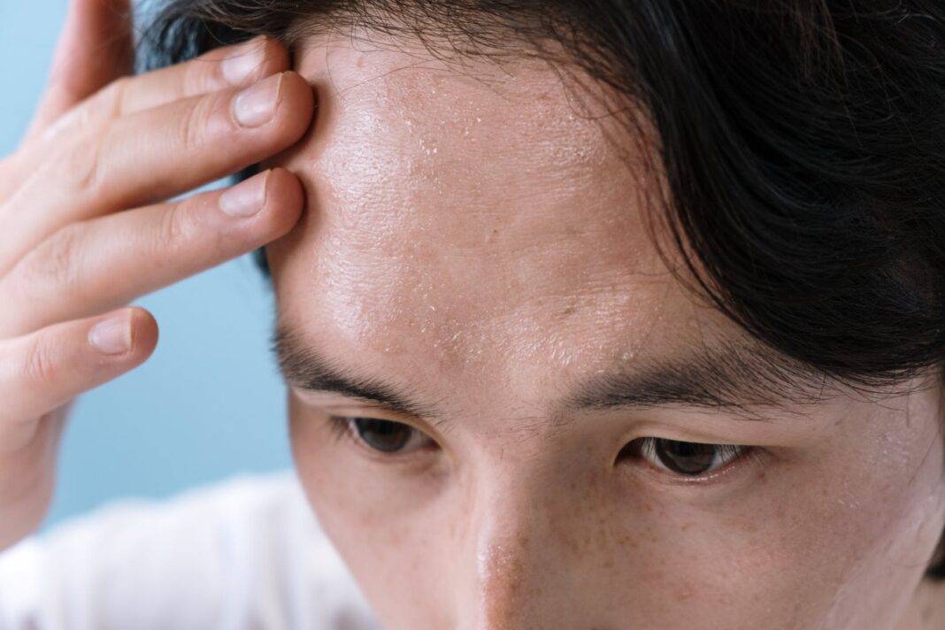 Workplace Hazards in Extreme Temperatures: Cold and Hot Environments ...